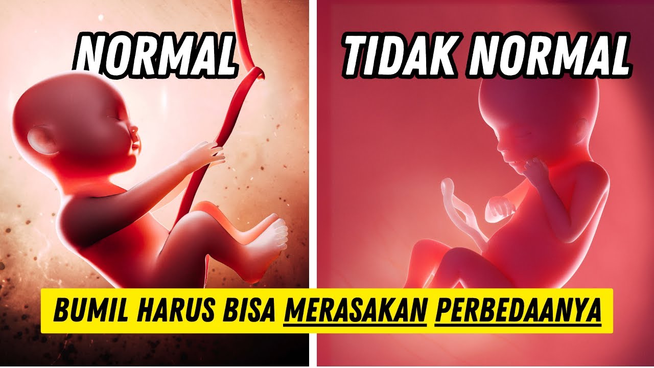 KUPAS TUNTAS GERAKAN JANIN YANG TIDAK NORMAL DAN CARA MENGATASINYA ...