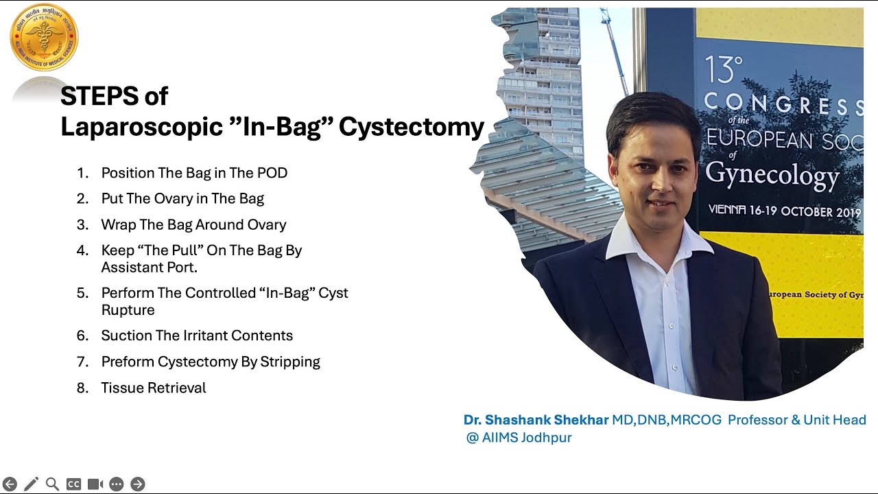 Lap For Beginners: Lap "In-Bag" Cystectomy of Dermoid Cyst - YouTube
