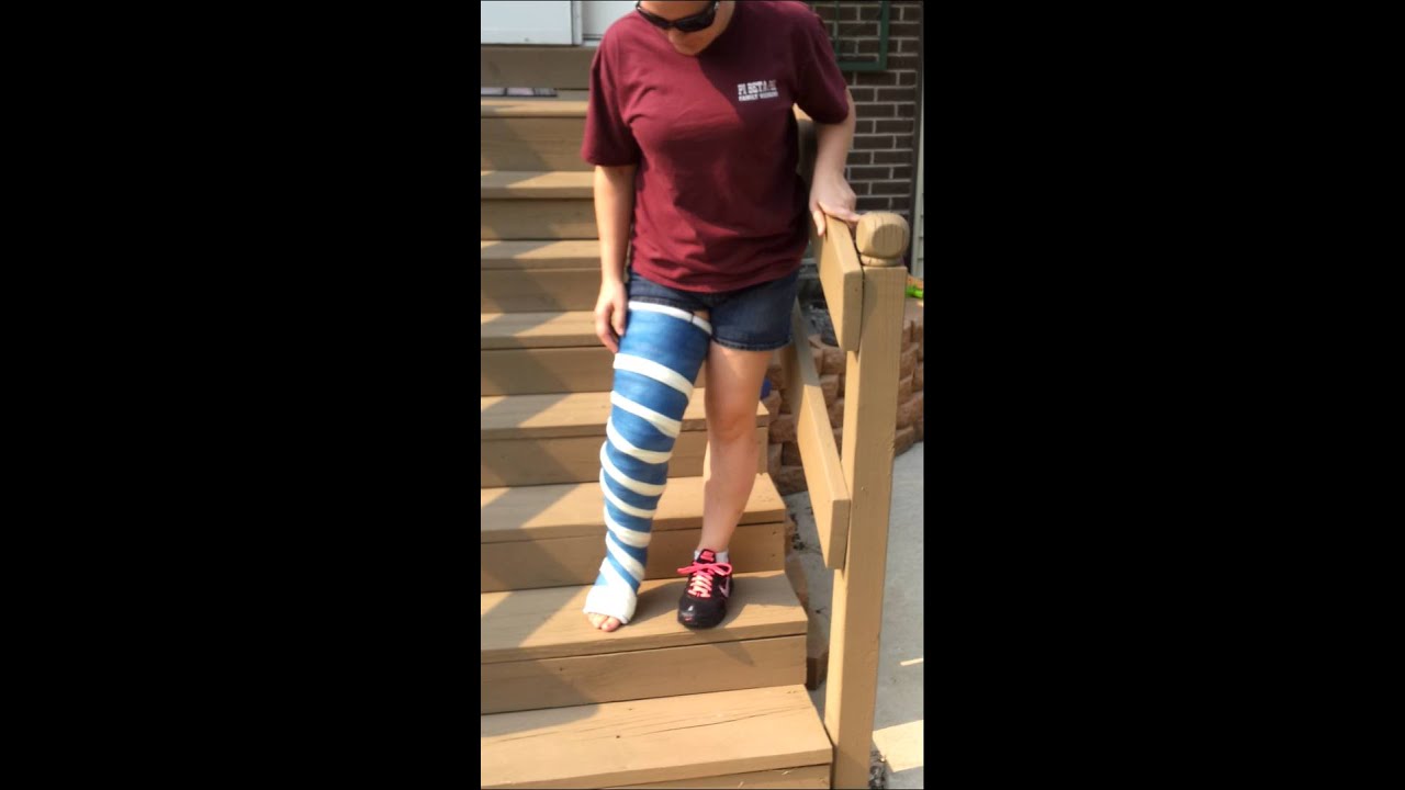 Kim talks about her toes sticking out of her cast - YouTube