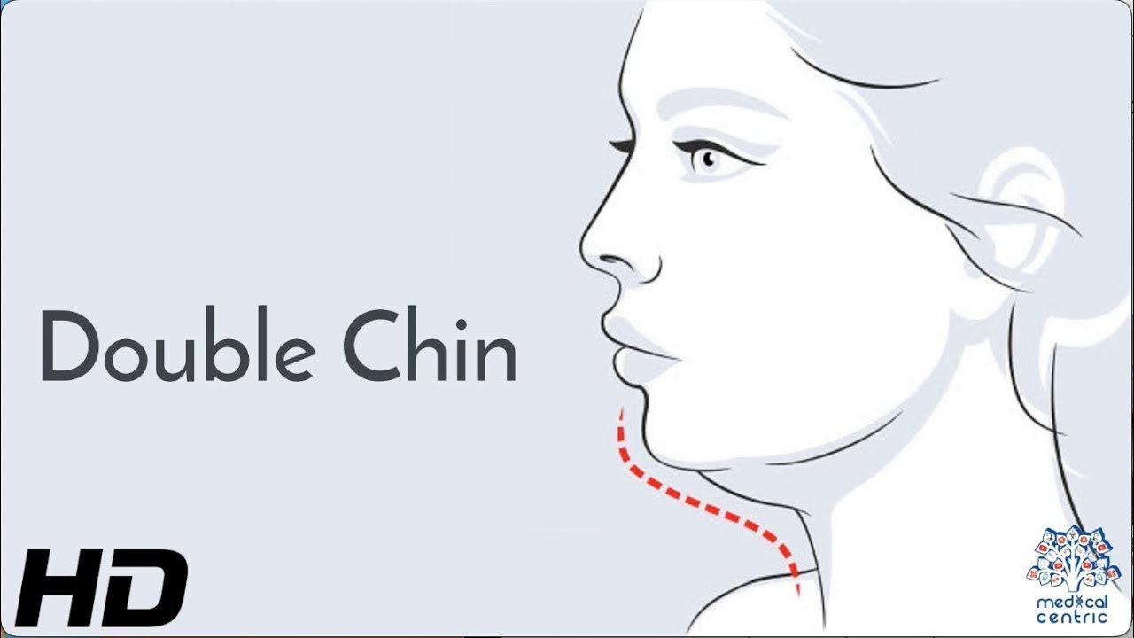 Double Chin No More: Tips and Tricks to Get a Defined Jawline - YouTube