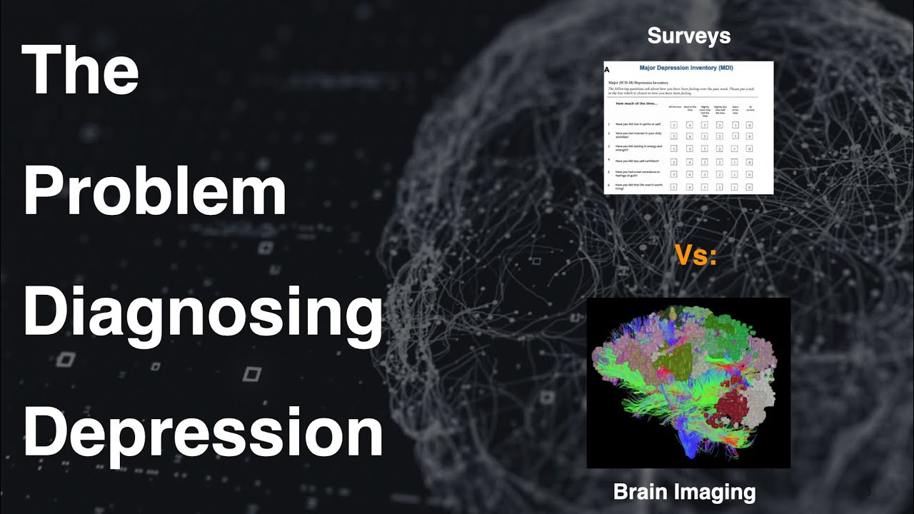 The Problem Diagnosing Depression (surveys vs brain imaging) - YouTube