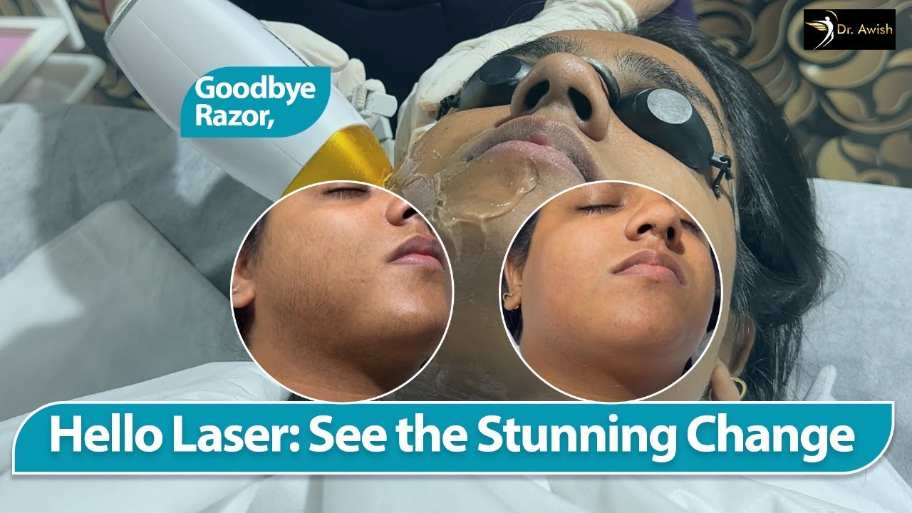 Benefits of Laser Hair Removal | Your Ultimate Guide | AWISH Clinic ...