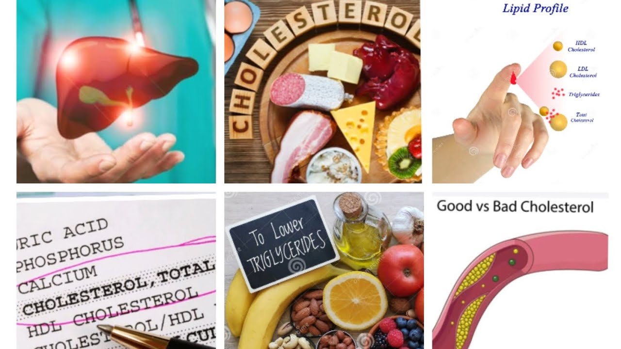 Cholesterol-Good vs Bad-5 Tips to Improve Cholesterol levels# ...