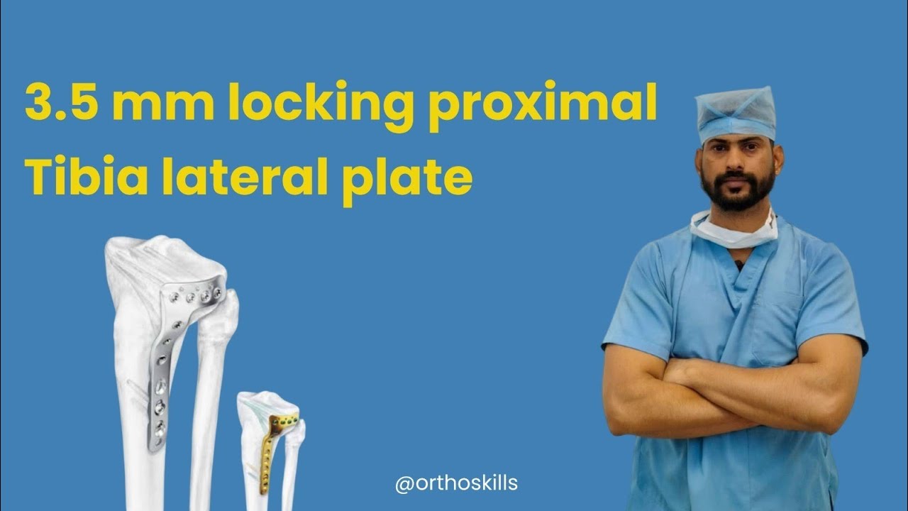 3.5 mm Proximal Tibia Locking Plate.Proximal Tibia Plating.Proximal ...