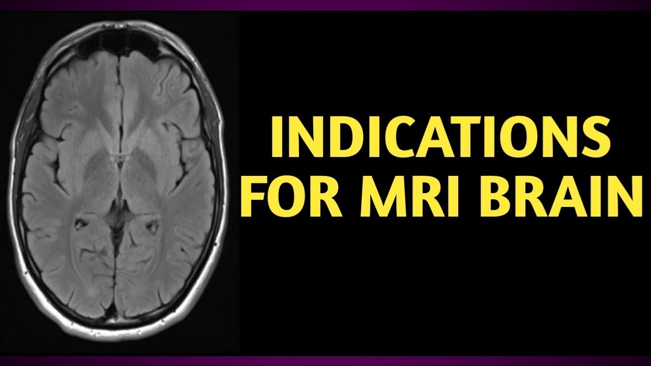Indications for MRI brain ( MRI BRAIN, BRAIN STEM LESION, BRAIN TUMOUR ...