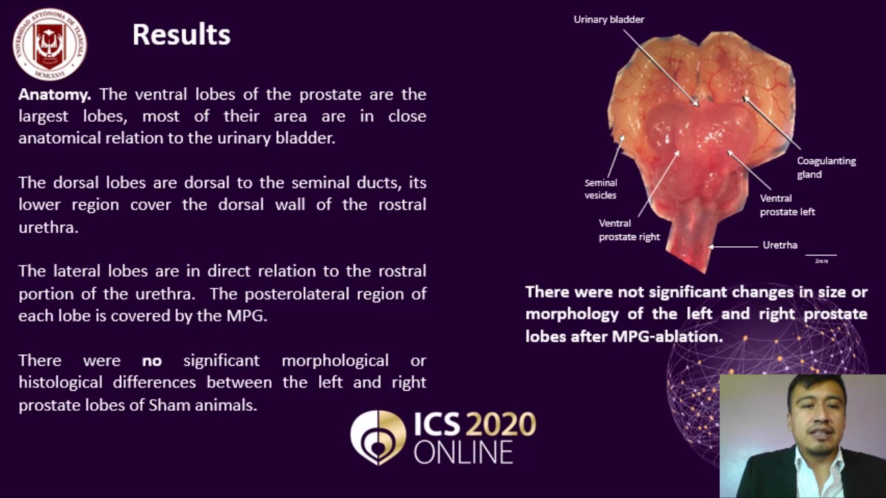 Prostate Anatomy Lobes