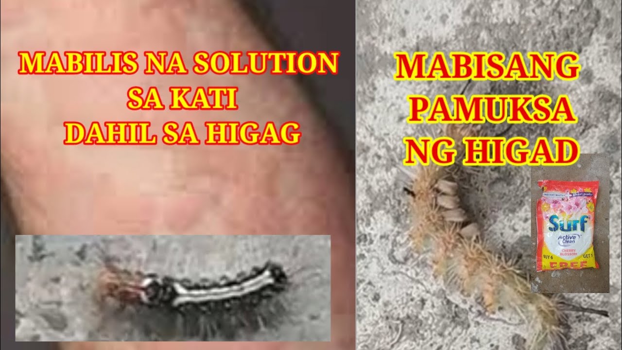 MABILIS NA SOLUTION SA KATI DAHIL SA HIGAD AT MABISANG PAMUKSA SA HIGAD ...