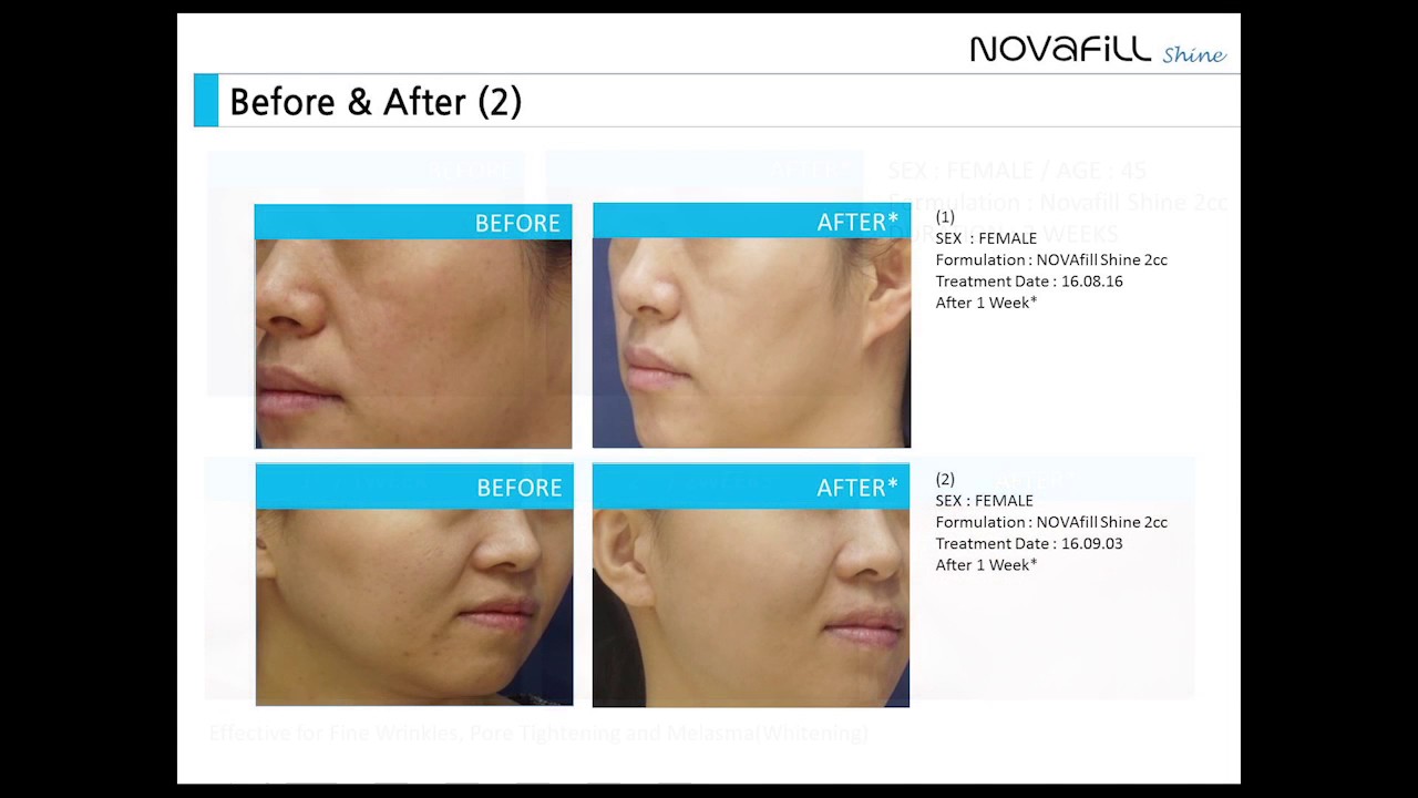 노바필 샤인 자료, novafill data, 노바필자료 - YouTube