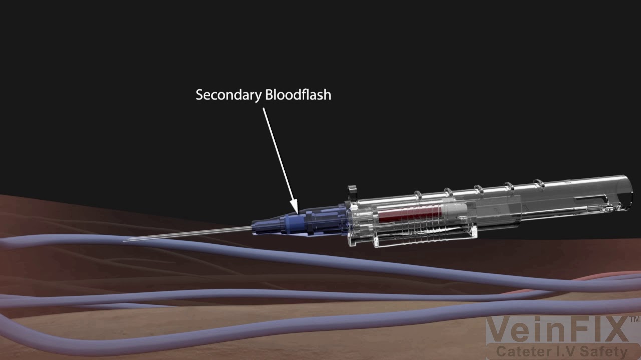Veinfix USA market - YouTube