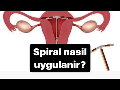 #spiral #mirena#ria#korunmayöntemleri #rahimiçiaraç