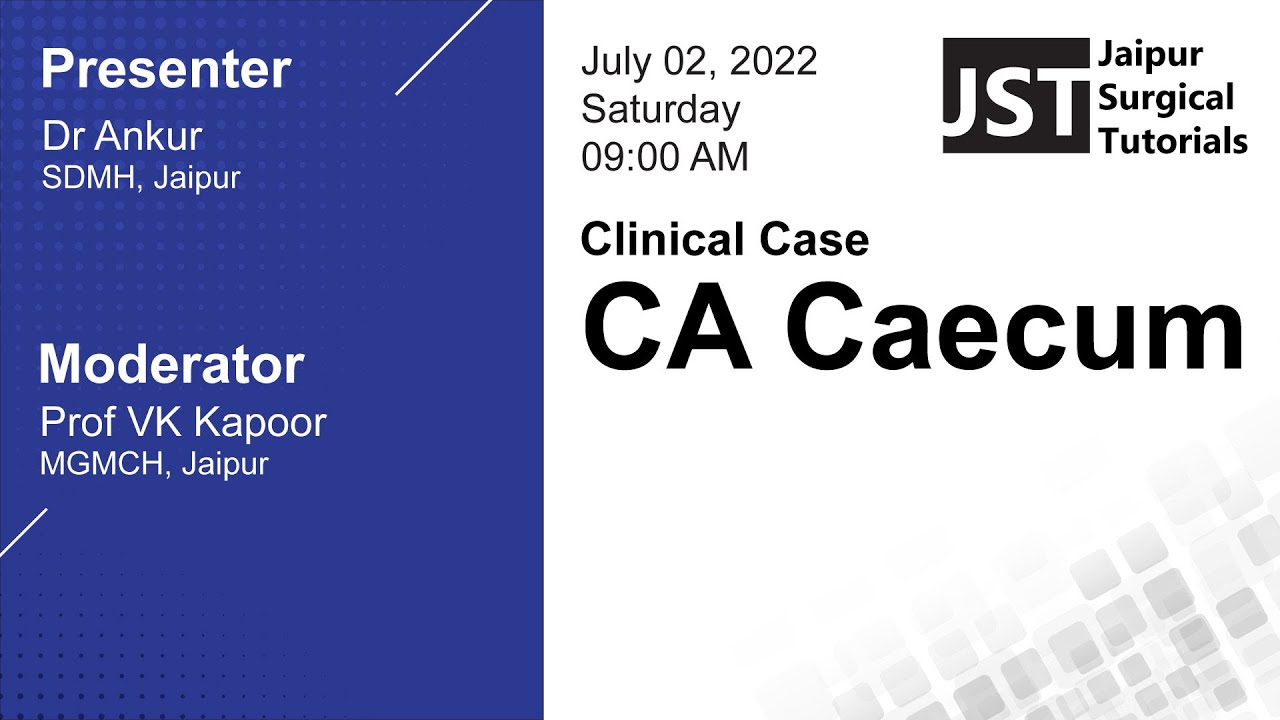Clinical Case on CA Caecum by DR Ankur, SDMH, Jaipur, Jaipur Surgical ...
