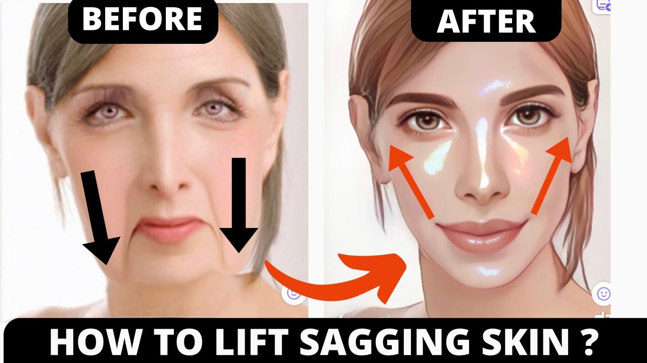 EFFECTIVE FACIAL EXERCISES FOR SAGGING SKIN, SAGGY JOWLS | GET DEFINED ...