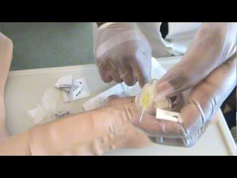 Peripheral IV Catheter Removal Demo (2 of 2) - YouTube