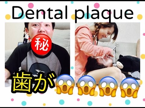 歯医者に通い始めました。Dental plaque tester - YouTube