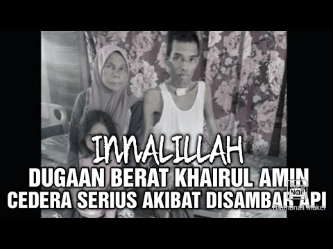 INNALILL∆H DUGA∆N B£RAT KHAIRUL AMIN C£DERA S£RIUS AKIB4T DI SAMB∆R ∆PI - YouTube
