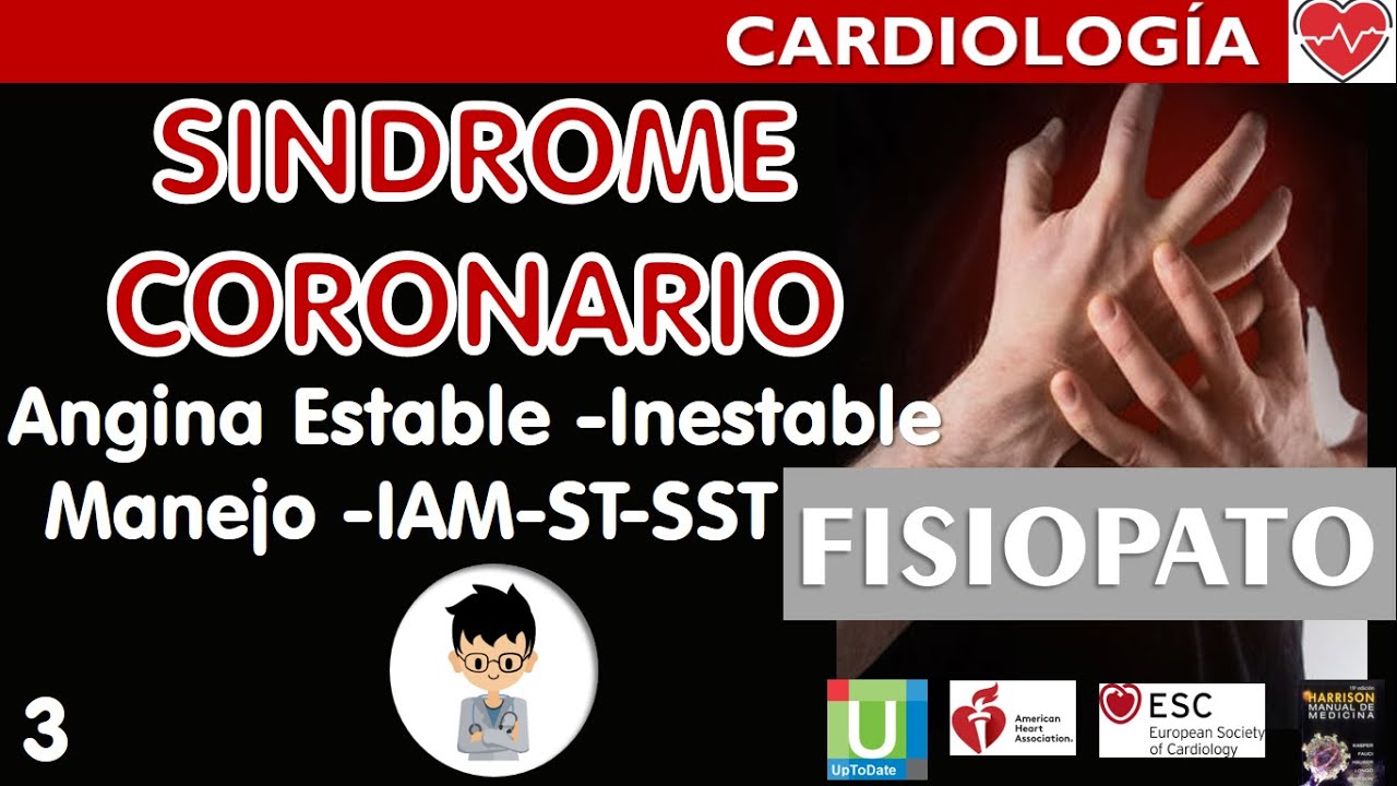 ANGINA ESTABLE INESTABLE, MANEJO del IAM con y sin ELEVACIÓN ST ...
