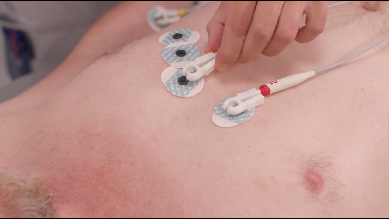 EKG Elektroplacering - ECG electrode application - YouTube
