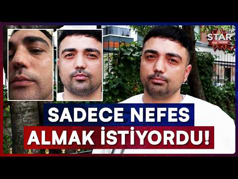 Horlama Şikayetiyle Gitti, Hayatı Kabusa Döndü! | Star Ana Haber
