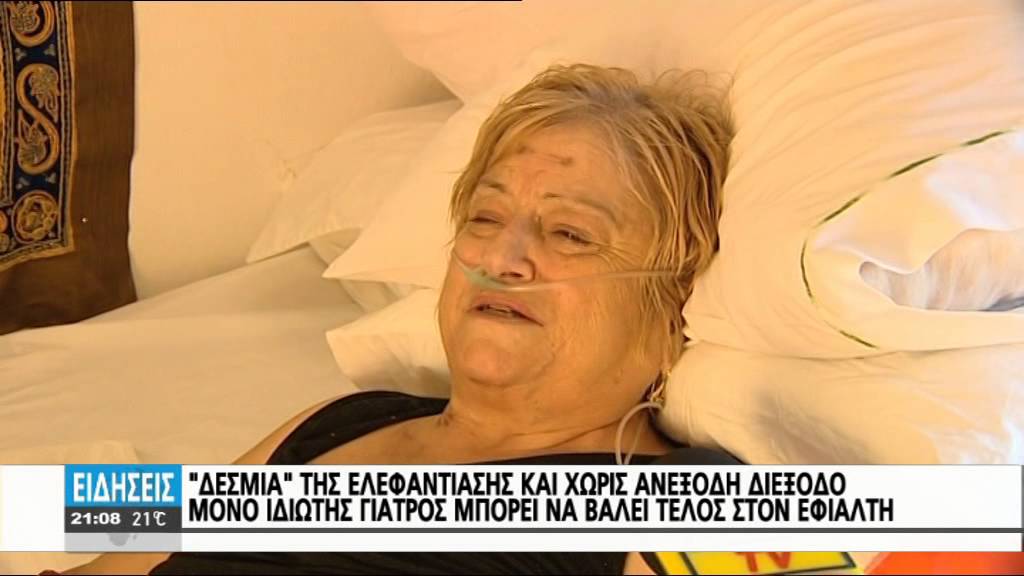 ΓΥΡΝΑ ΤΗΝ ΠΛΑΤΗ ΤΟ ΕΣΥ ΣΕ 45ΧΡΟΝΗ ΜΕ ΕΛΕΦΑΝΤΙΑΣΗ ΣΤΟ ΠΟΔΙ - YouTube