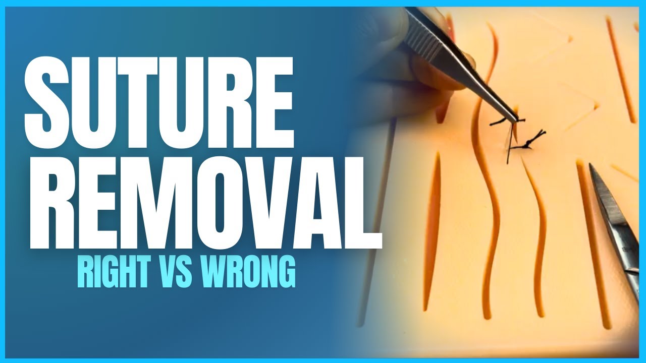 How to Remove Sutures Properly (Right vs Wrong Technique) - YouTube