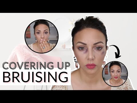 How Cover up Bruises | Covering Dark Area with Makeup | Amber Lykins ...