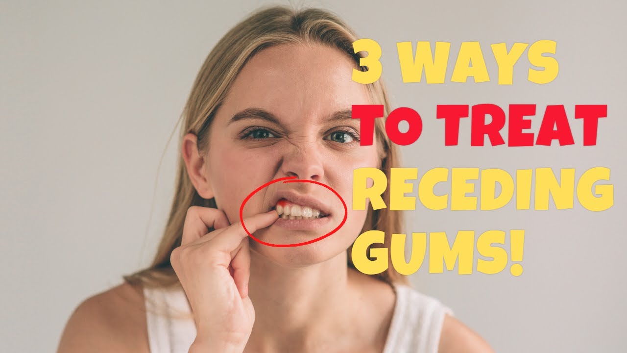 3 Quick Natural Ways To Treat Receding Gums Youtube