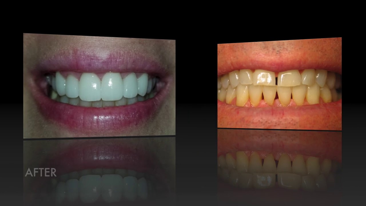 Dr. Rick Dentistry - Before & Afters - YouTube