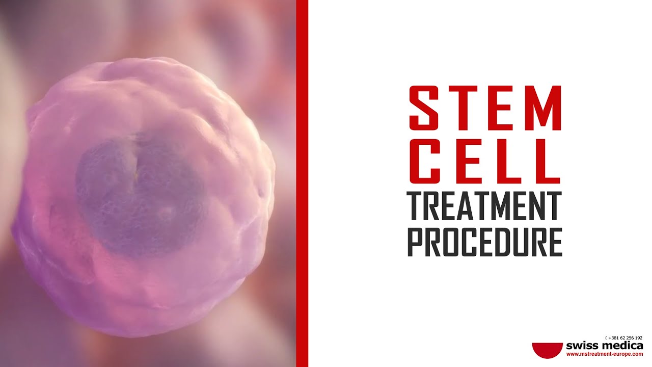 Stem cell treatment procedure - YouTube