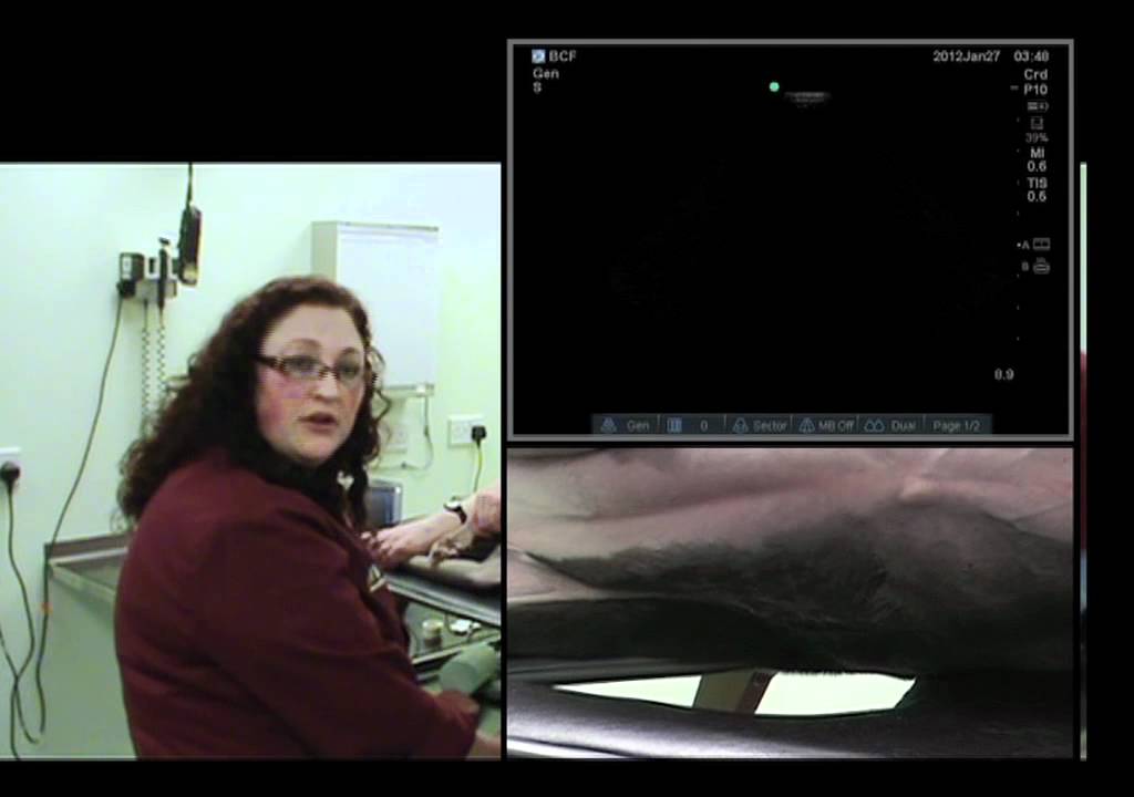 IMV imaging cardiac ultrasound video 5 - Right parasternal long axis 5 ...