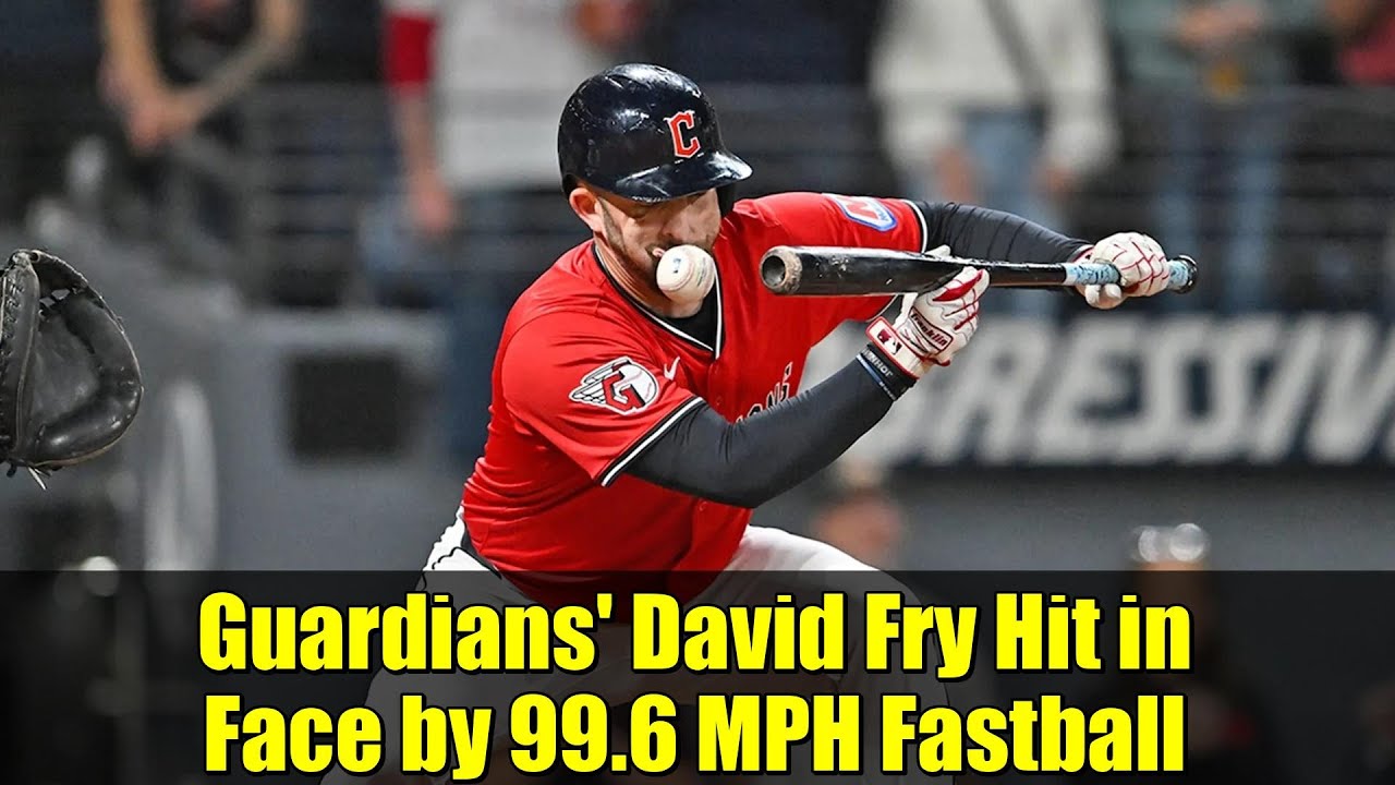 Guardians' David Fry Hit in Face by 99.6 MPH Fastball | Hospitalized ...