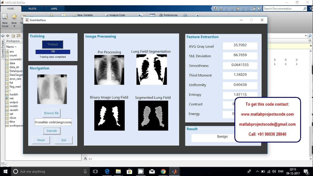 Lung cancer detection and classification using binary and segmentation - YouTube