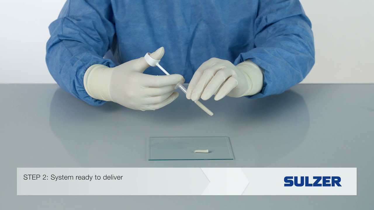 Sulzer Putty Delivery System for Implantology (Medmix™ ErgoSyringe ...