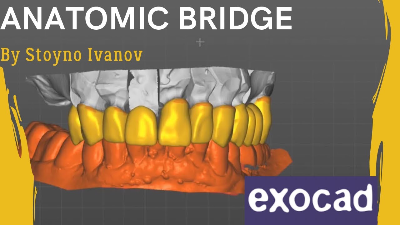 Fastest Exocad Video Tutorial - Anatomic Bridge - YouTube