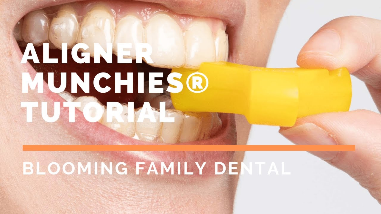 Aligner Munchies® Tutorial - YouTube