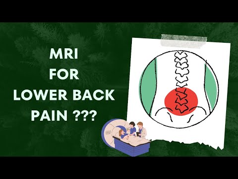 MRI For Lower Back Pain | Back Pain | Spine | MRI | CT Scan | X-ray ...