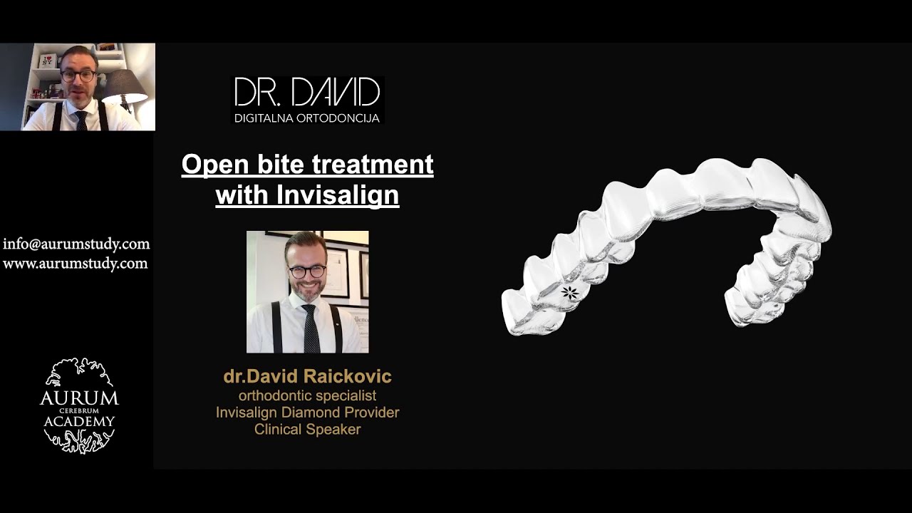 PREVIEW. David Raickovic - Open bite treatment with Invisalign - YouTube
