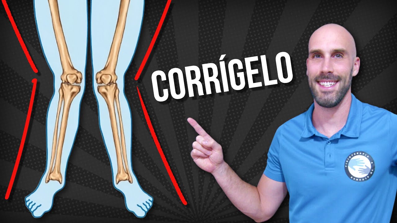 6 EJERCICIOS para CORREGIR LAS RODILLAS EN VALGO - YouTube