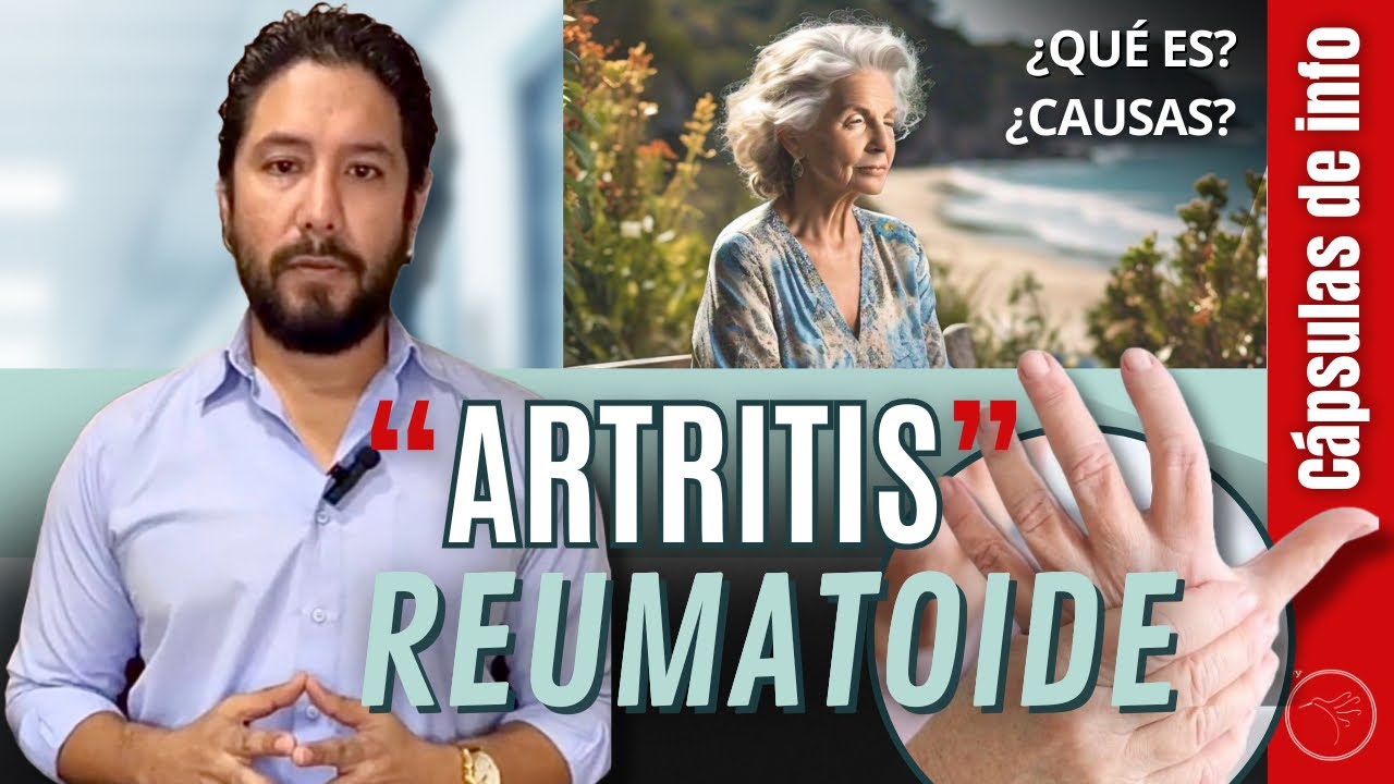 CI # 009 | ARTRITIS REUMATOIDE: ¿QUÉ es? Causas, Síntomas y Tratamiento ... CI # 009 | ARTRITIS REUMATOIDE: ¿QUÉ es? Causas, Síntomas y Tratamiento ...