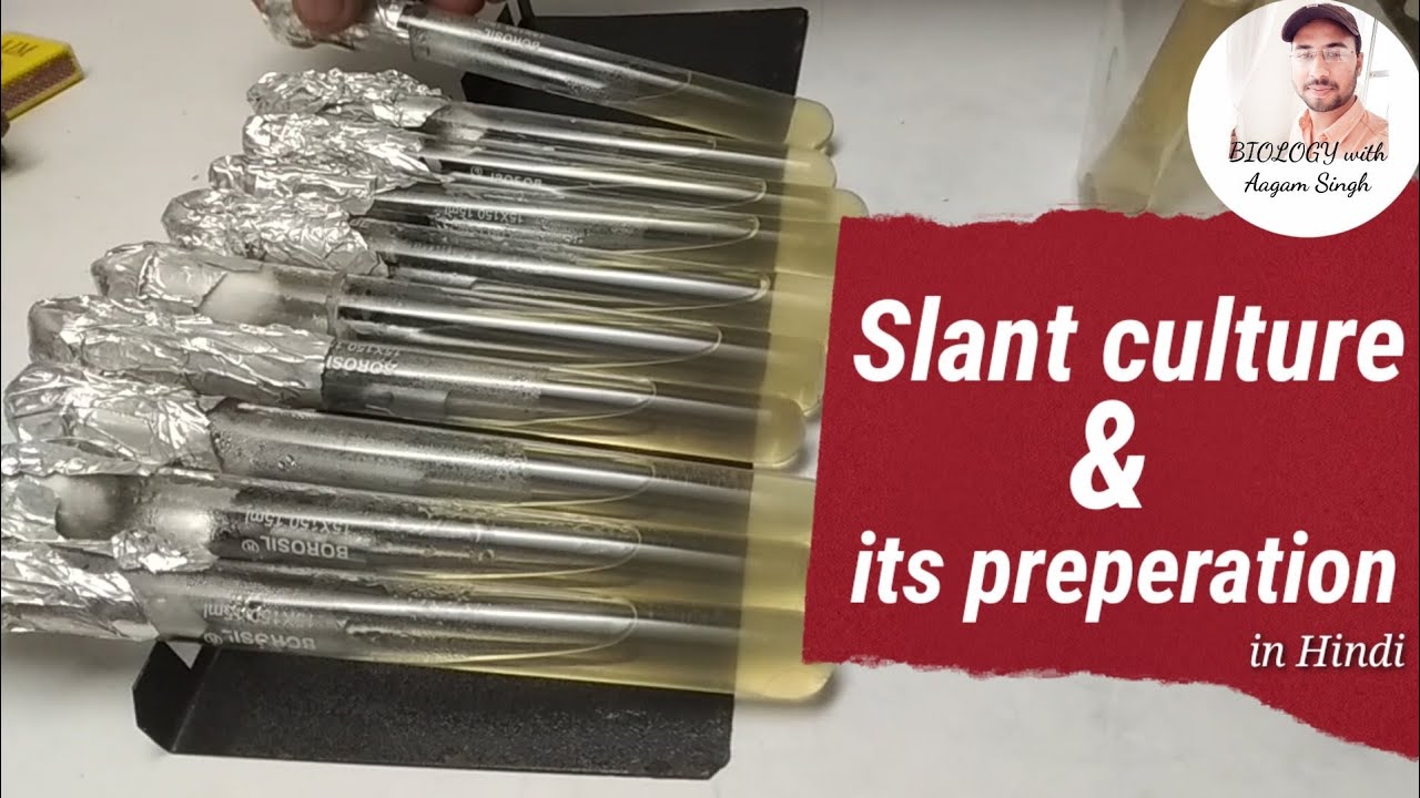 microbial slant culture in hindi | microbes under test tubes | Nutrient ...