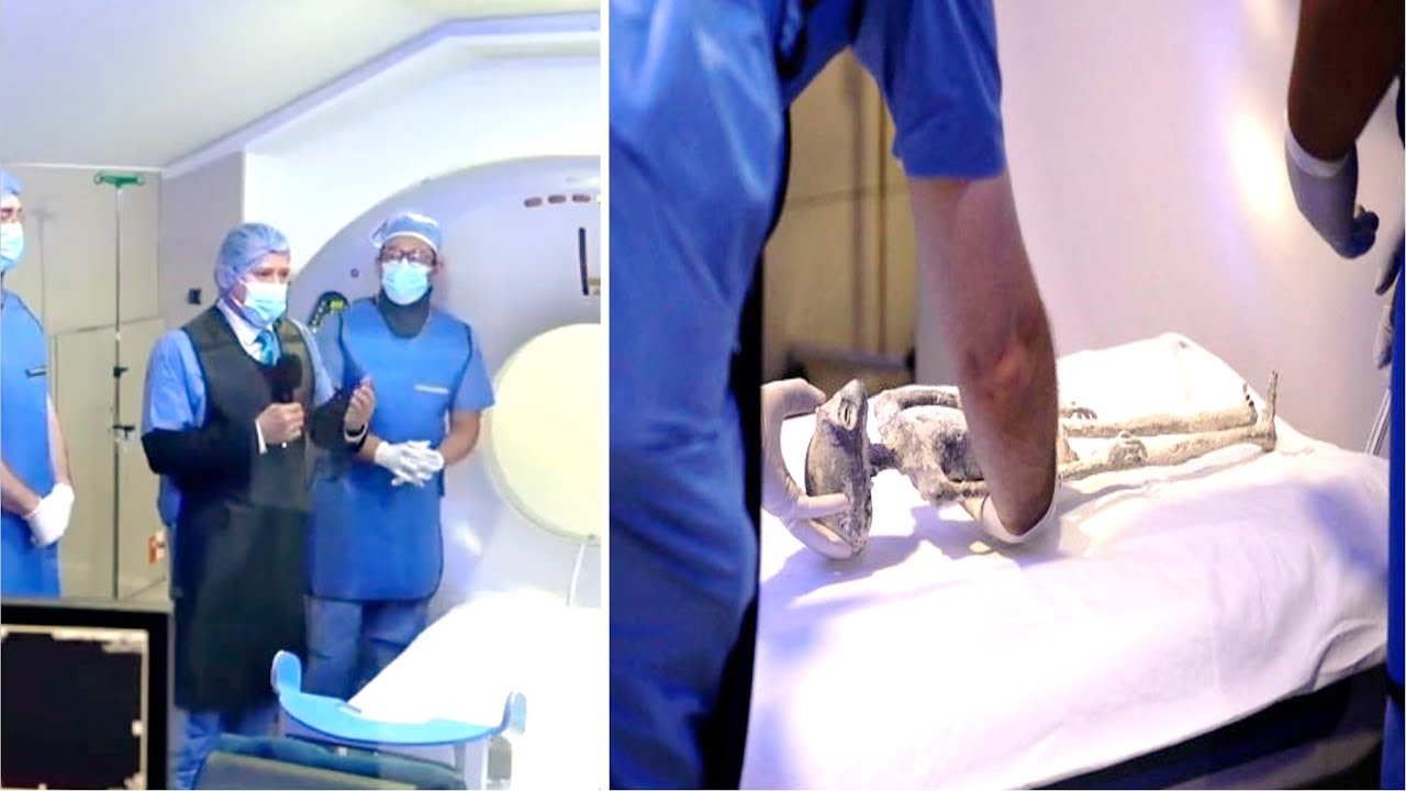 The Aliens Were Just Put Through X-Ray Machines & CT Scans And They ...