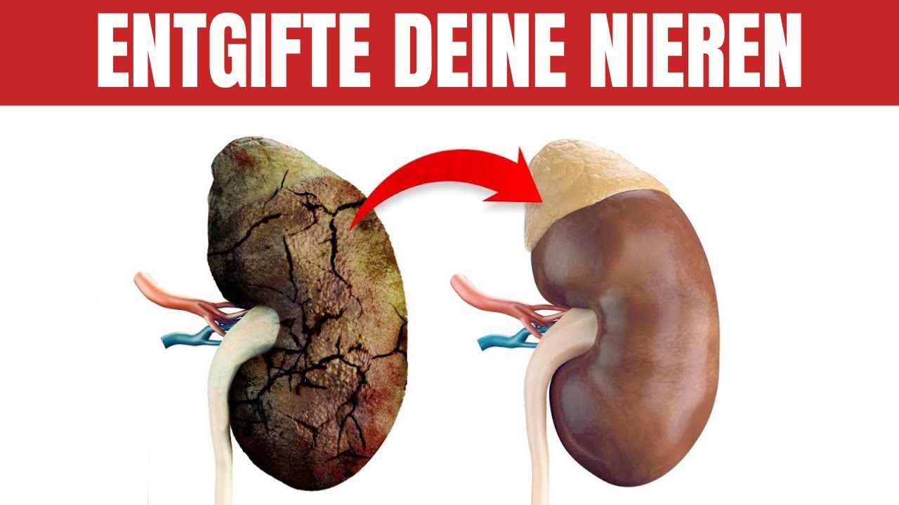 Das kannst du tun, um Harnsäure aus den Nieren zu entgiften - YouTube