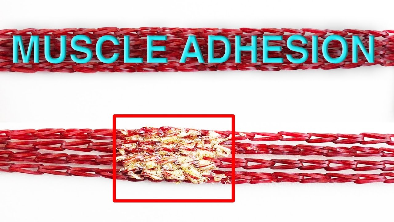 Muscle Adhesion Model - YouTube