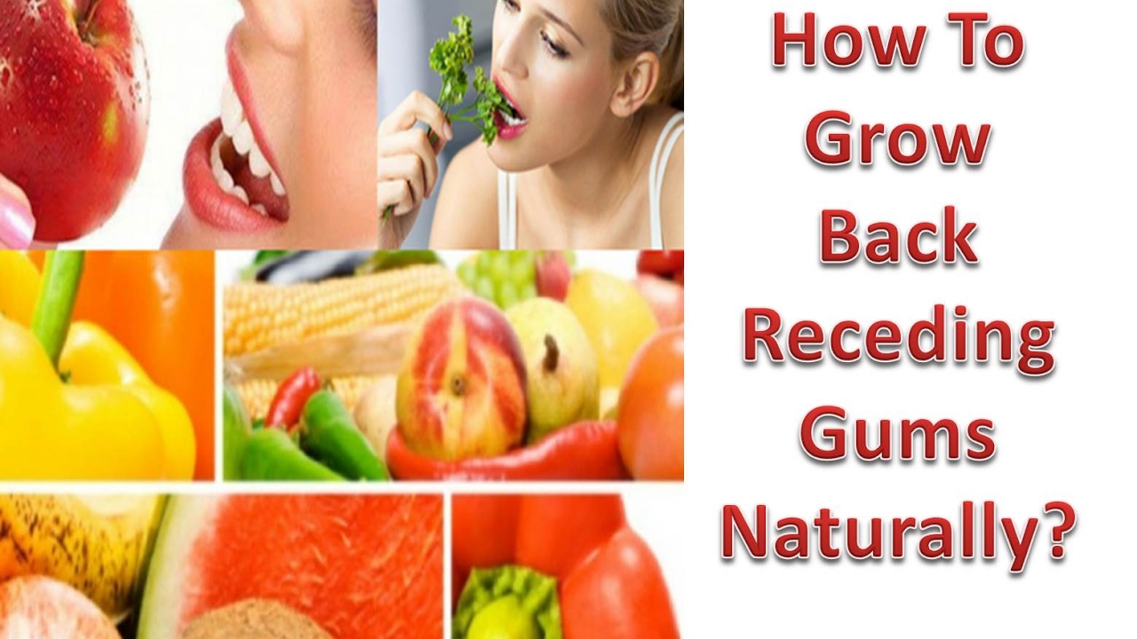 How To Grow Back Receding Gums Naturally? - YouTube