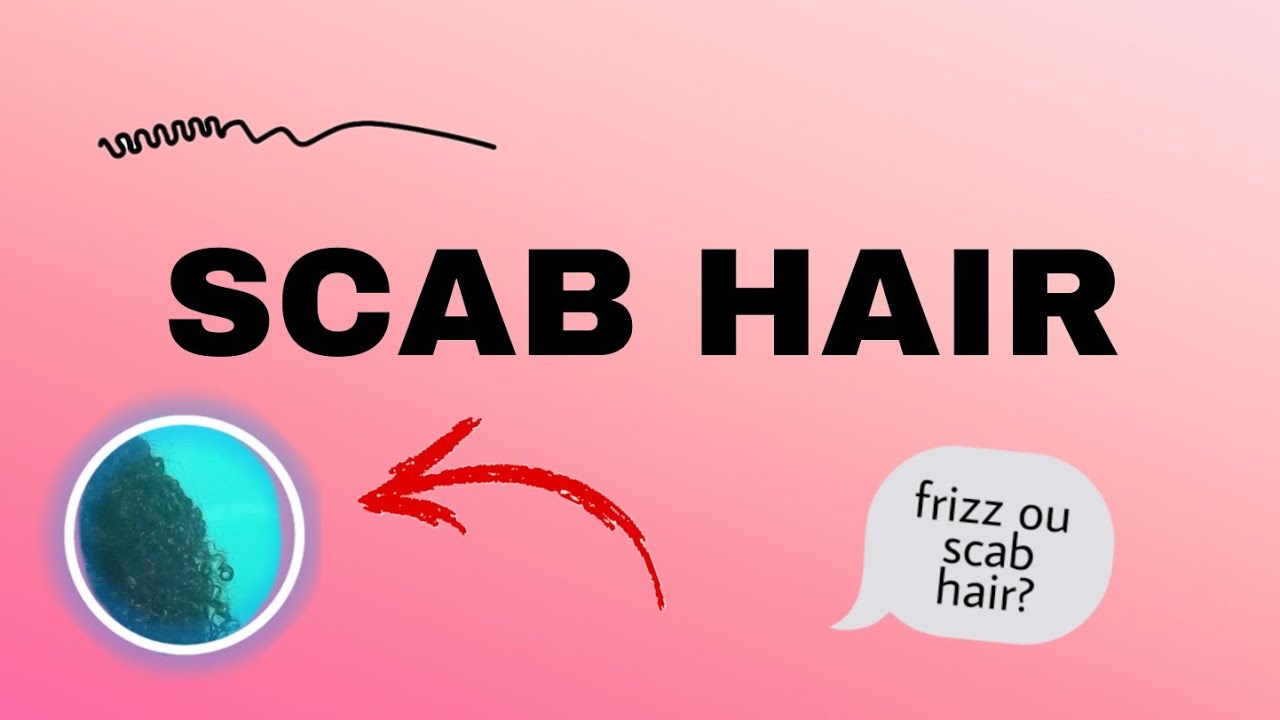 SCAB HAIR: OQUE É/ COMO TRATAR - YouTube