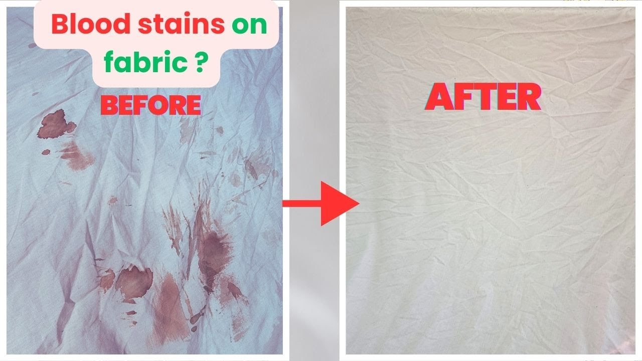 LESS THAN 5 MINS BLOOD STAINS REMOVAL FROM FABRIC - YouTube