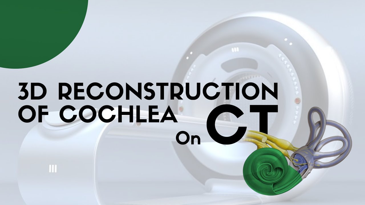 CT 3D reconstruction of cochlea - YouTube