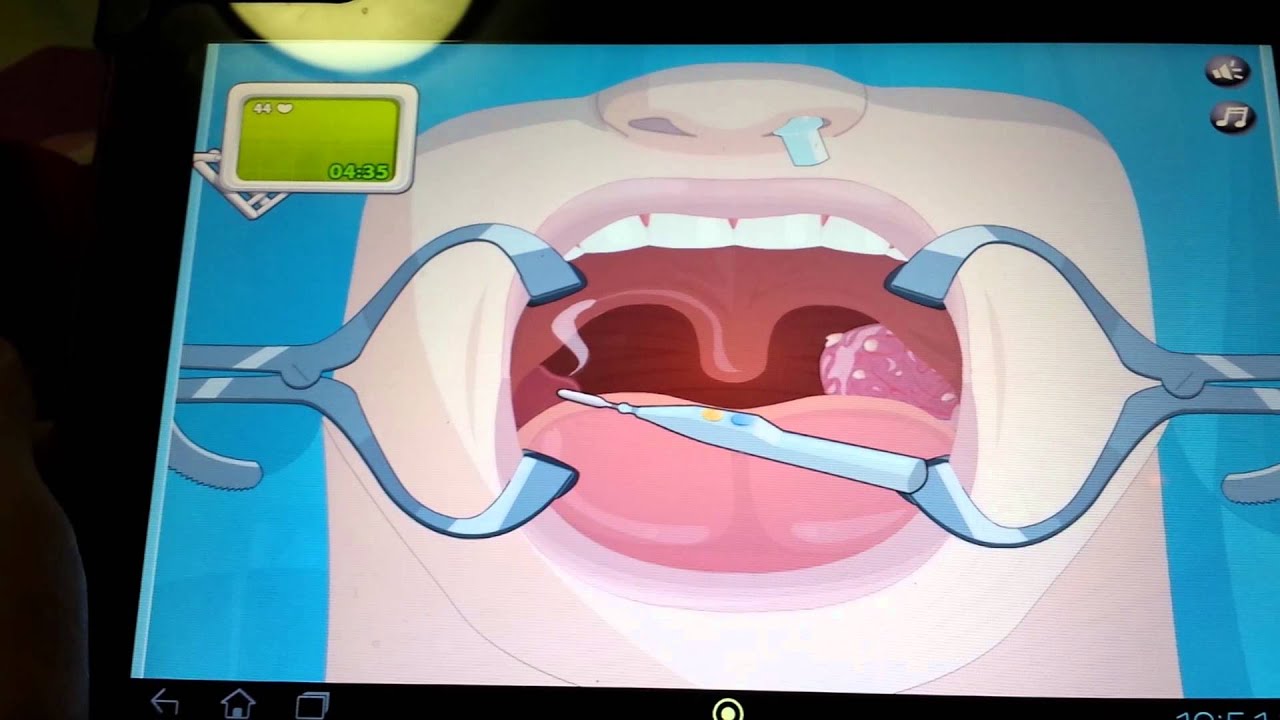 Operate now tonsil surgery - YouTube
