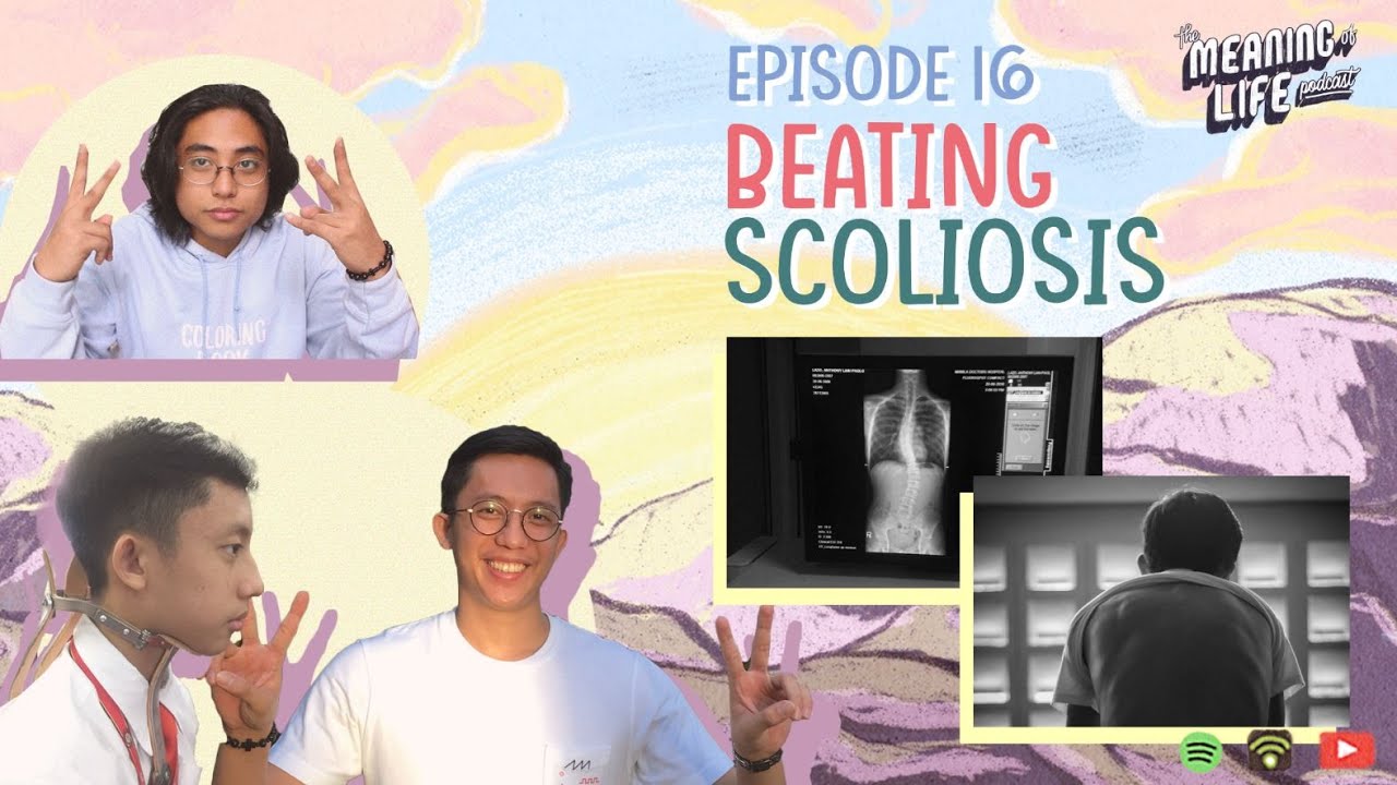 Beating Scoliosis ft. Lian Lazo - YouTube