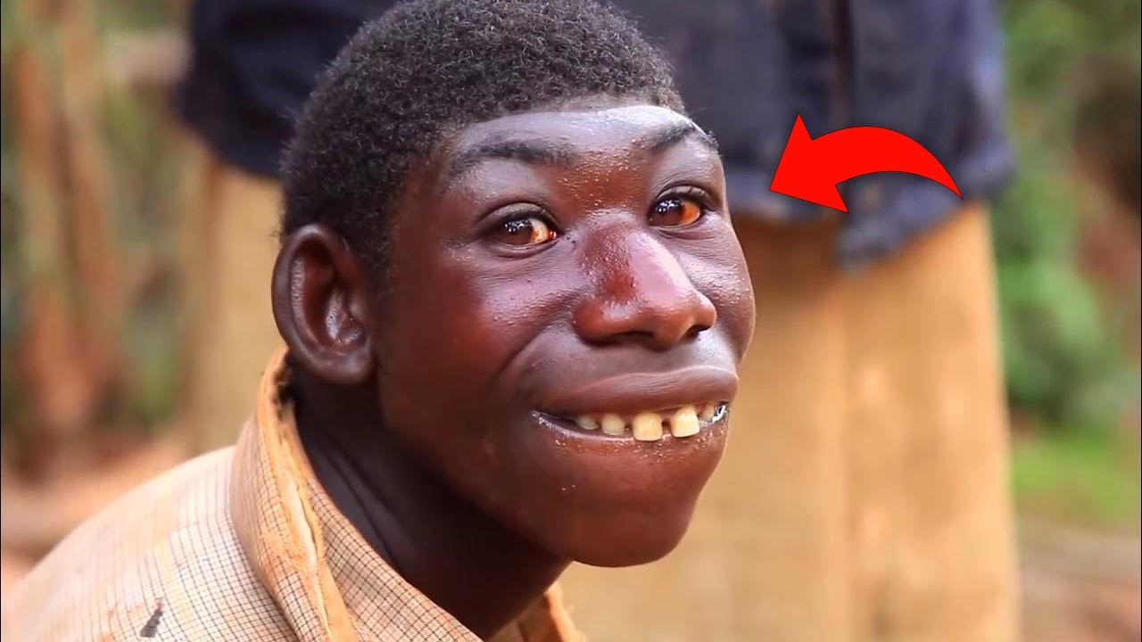 They Called Him Monkey Now He is Famous All Over The World - YouTube