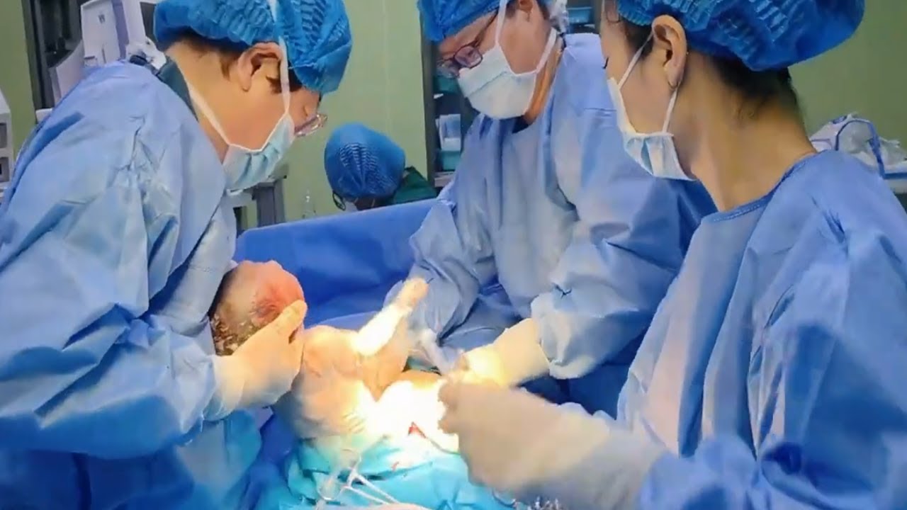 C-SECTION DELIVERY | three baby birth live | Dad carefully hugs the ...